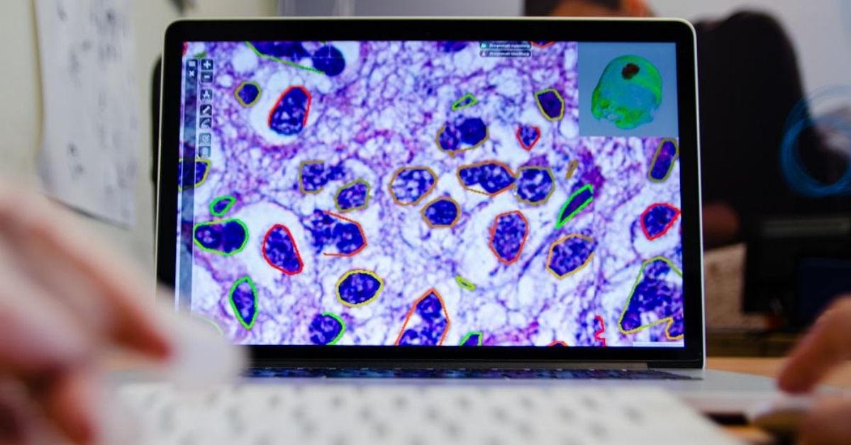 How Technology Is Changing The Outlook Of Breast Cancer Treatment?